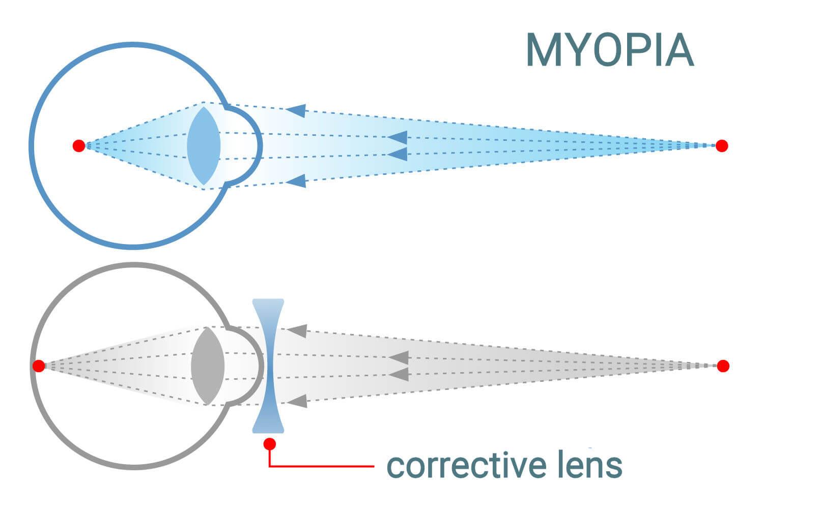 How do we see? - Viewpoint Optometrist